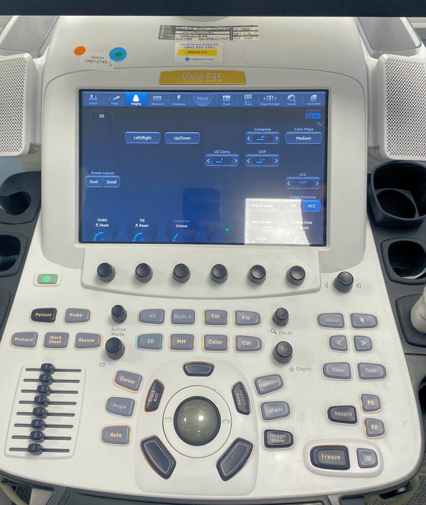 GE Vivid E95 Ultrasound System