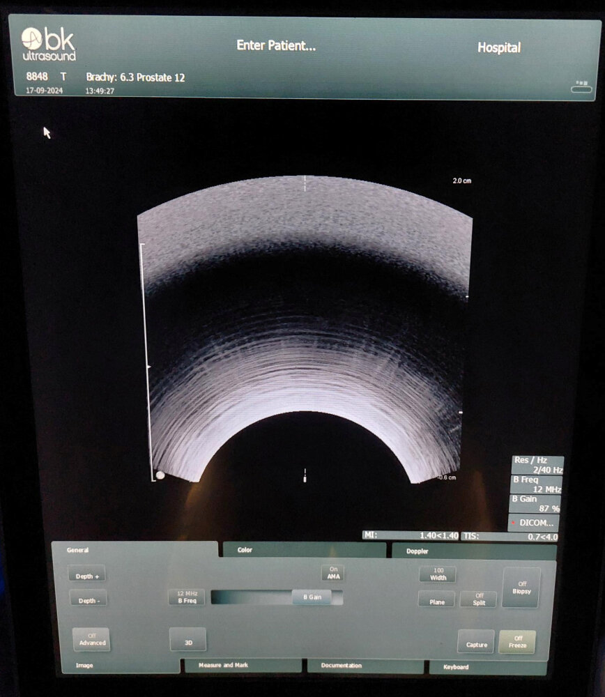 BK Medical Flex Focus 800 Ultrasound System