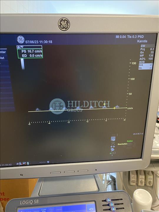 GE Logiq S8 Ultrasound