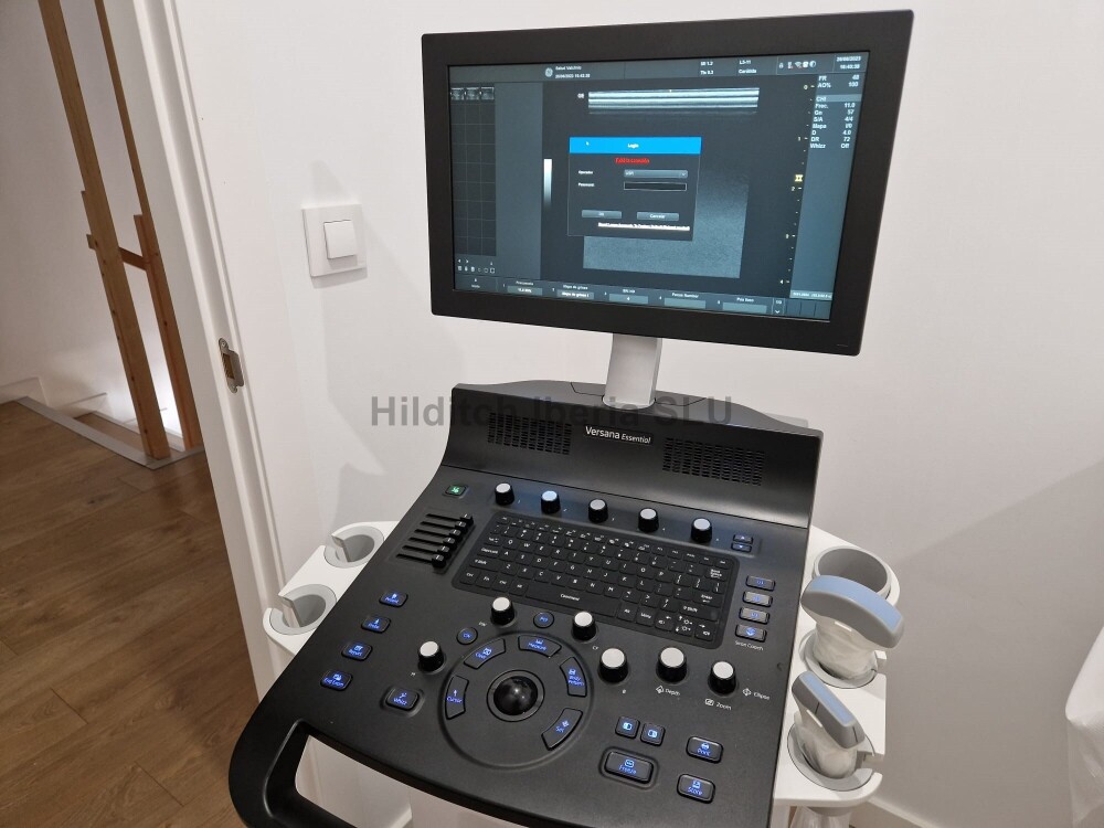 GE Versana Essential Ultrasound