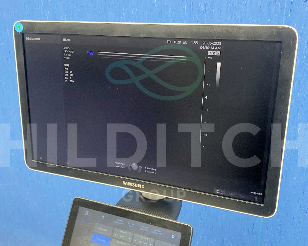 Samsung HS40 Ultrasound