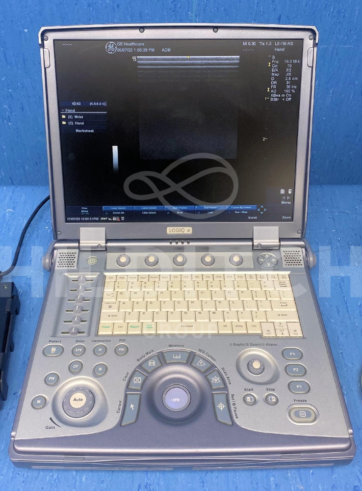 GE Logiq e Ultrasound System