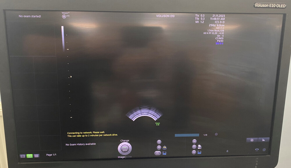 GE Voluson E10 BT18 Ultrasound System