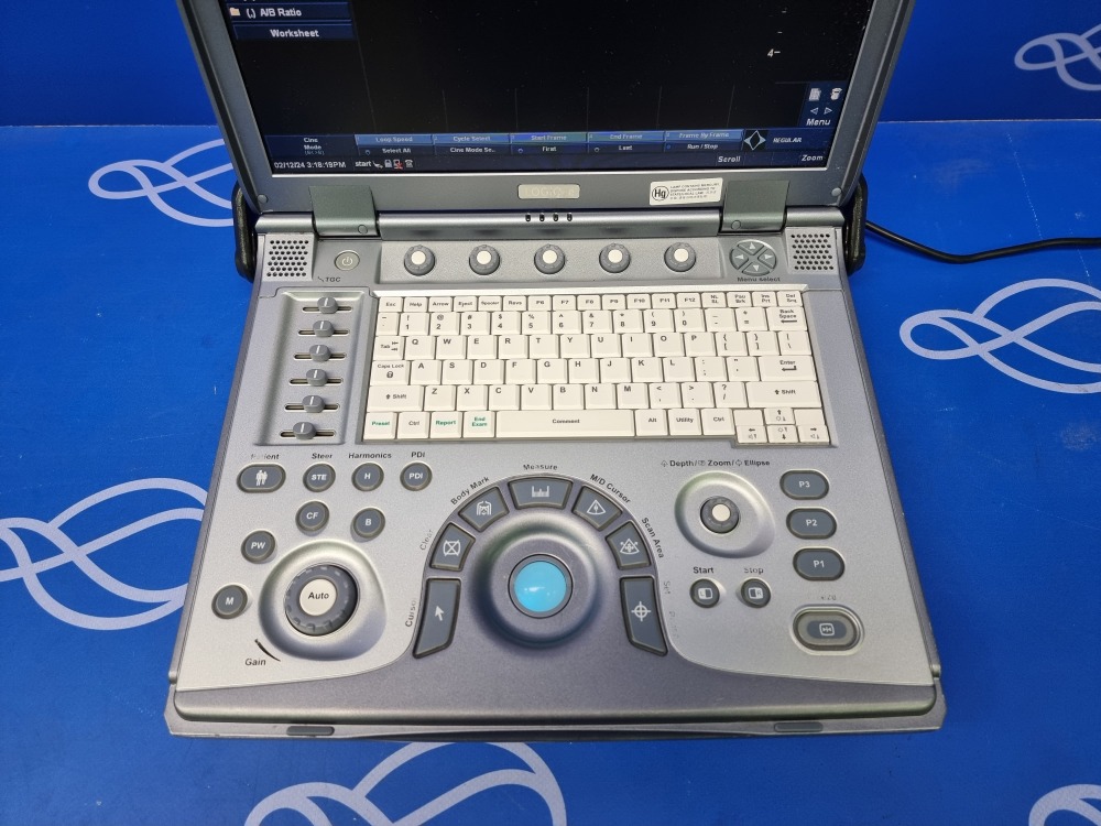 GE Logiq e Portable Ultrasound
